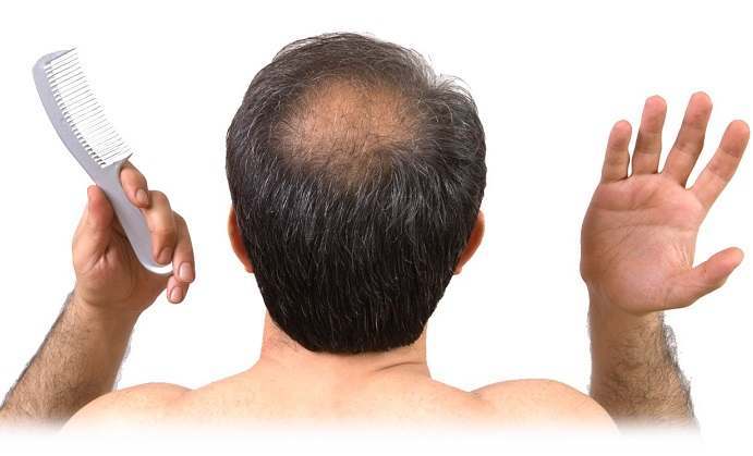 How to Stimulate Hair Follicles